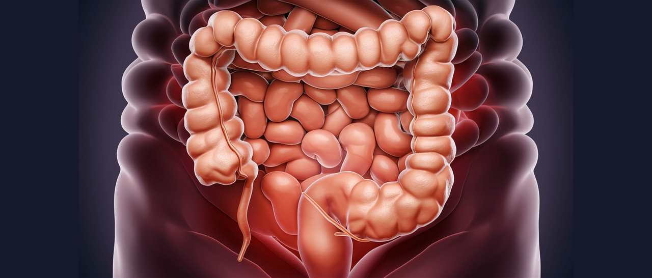 Cómo saber si el colon está limpio para una colonoscopia - Movida Sana